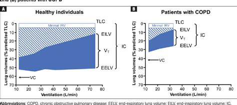 Figure 1 From Dyspnea And Hyperinflation In Chronic Obstructive