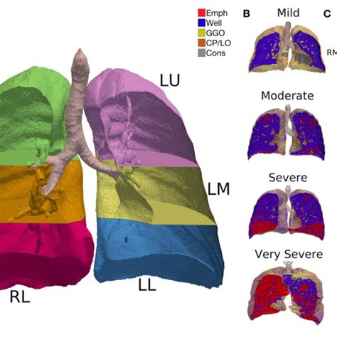 A CT Image Segmentation In A Representative Subject R Right Lung Download Scientific