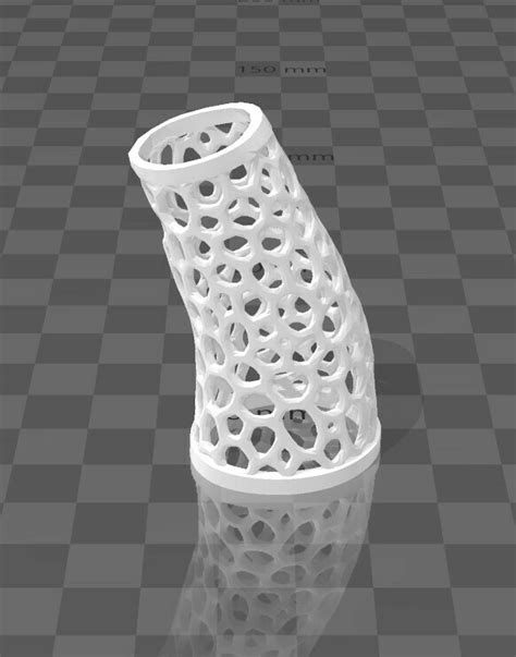 3mf File Finger Splint Finger Splint 🩻・model To Download And 3d Print・cults 3mf File Finger Splint Finger Splint 🩻・model To Download And 3d Print・cults