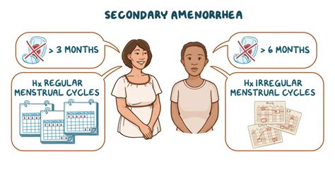 Approach To Secondary Amenorrhea Clinical Sciences Osmosis Video Library