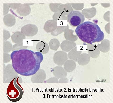 🔬esfregaço De Hematologia Hemoterapia Por Perla Vicari