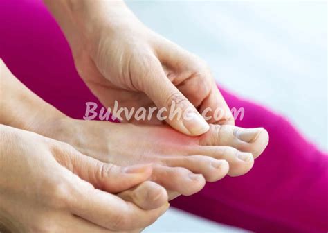 Намаляване на пикочната киселина се постига с определени храни и