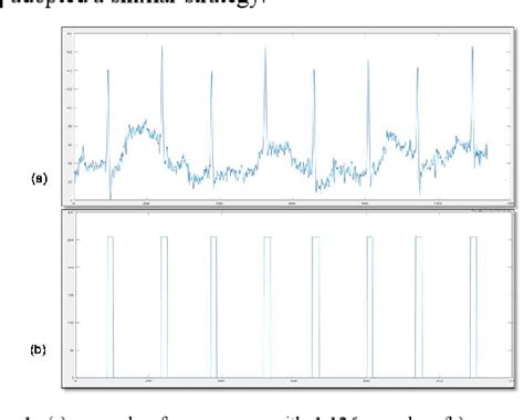 Figure 1 From Semantic Segmentation Of Qrs Complex In 12 Lead Ecg