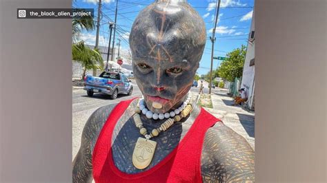 Und Lässt Sich Dafür Sogar Finger Amputieren Anthony Loffredo Möchte Aussehen Wie Ein Alien