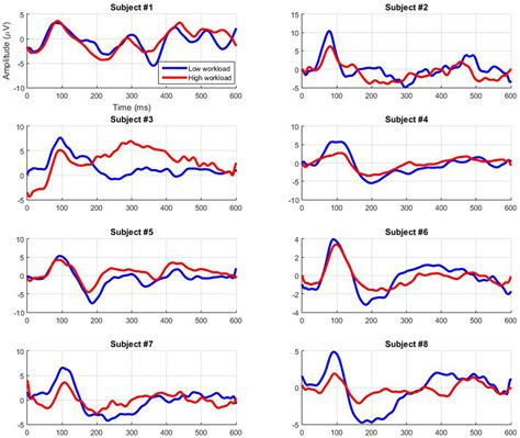 Auditory Evoked Responses Abr