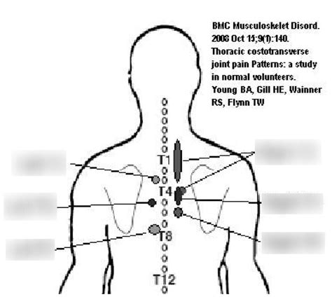 Costotransverse Facet Joint Referral Patterns Diagram Quizlet