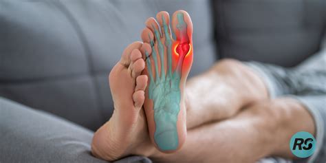 Big Toe Bursitis Effective Non Invasive Treatments Rs Podiatry Clinic