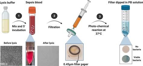 Spectrophotometer Bacteria At Jackson Nicolle Blog