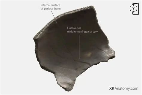 Parietal Bone Anatomy 3d Views Of Surfaces And Sutures Free