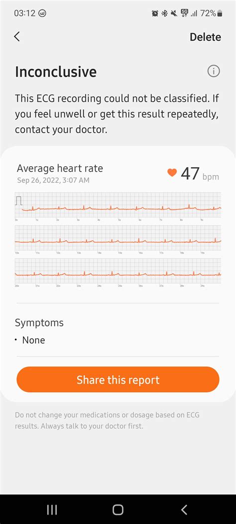 I Keep Getting Inconclusive Ecg Reading Because My Heartrate Is Too