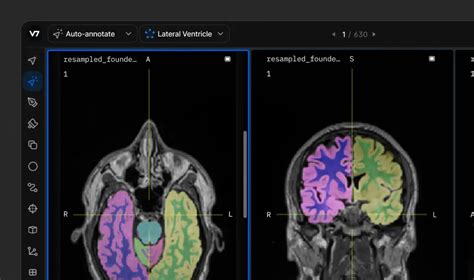 Segment Anything Model SAM Intro Use Cases V Tutorial