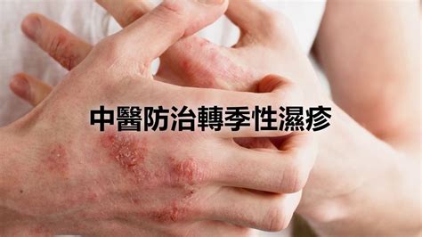【德善堂】中醫防治轉季性濕疹 Youtube