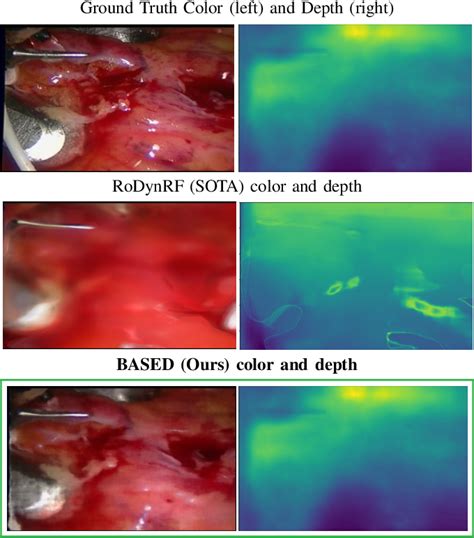 Figure 1 From Based Bundle Adjusting Surgical Endoscopic Dynamic Video