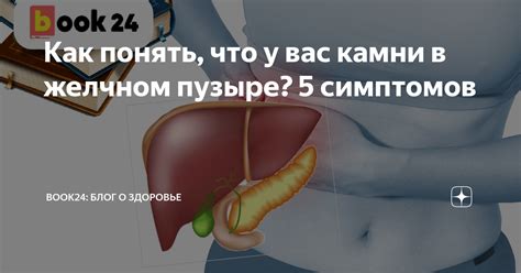 Как понять что у вас камни в желчном пузыре 5 симптомов Book24 блог о здоровье Дзен