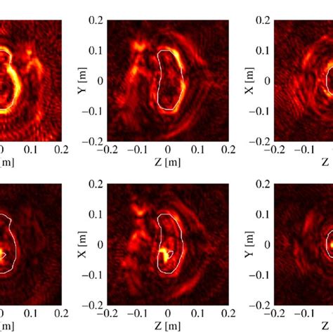 Slices Of The Amplitude Of The Reconstructed Induced Currents Using The Download Scientific