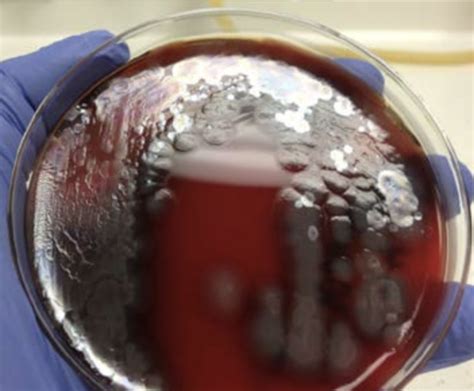 Pseudomonas Flashcards Quizlet