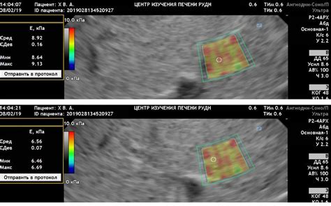 Shows An Example Of Comparing The Results Of Elasticity Measurements Download Scientific