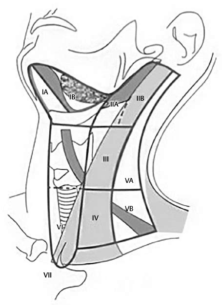 Modified Radical Neck Dissection Ento Key