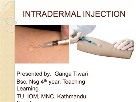 Intradermal Injection Introduction Procedure Complications Pptx
