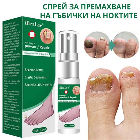 Спрей против гъбички на ноктите