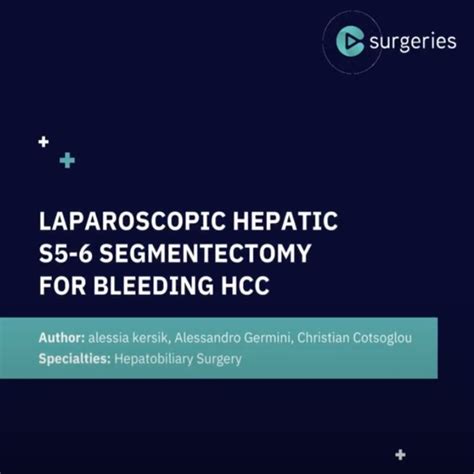 Csurgeries On Linkedin Video Laparoscopic Hepatic S5 6 Segmentectomy For Bleeding Hcc Learn…