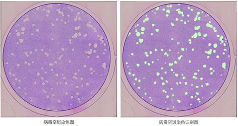 高通量细胞分析助力细胞与基因治疗产品加速开发