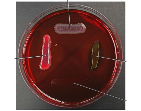 Chpt 16 Emb Test Results Quiz