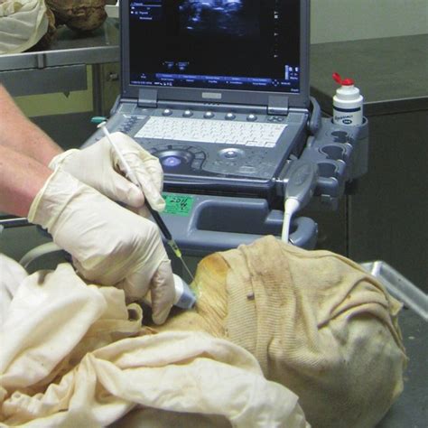 Methylene Blue Dye Injection Using Ultrasound Probe In A Midline