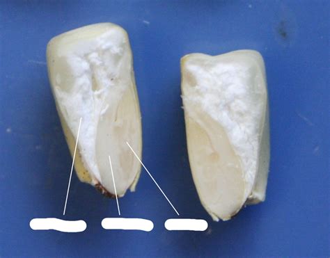 Corn Anatomy 1 Diagram Quizlet