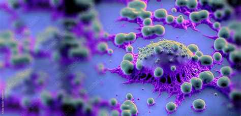 Tumor Microenvironment Concept With Cancer Cells T Cells Nanoparticles Cancer Associated