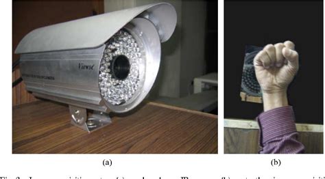 Metacarpophalangeal Joint Structure Semantic Scholar