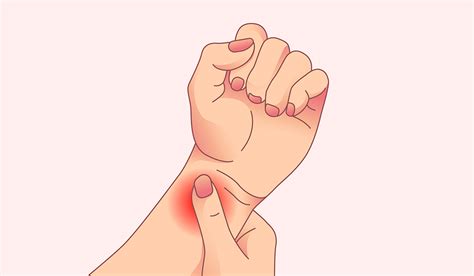 Gout What Is Causes Diagnosis And Treatment Healthsimply