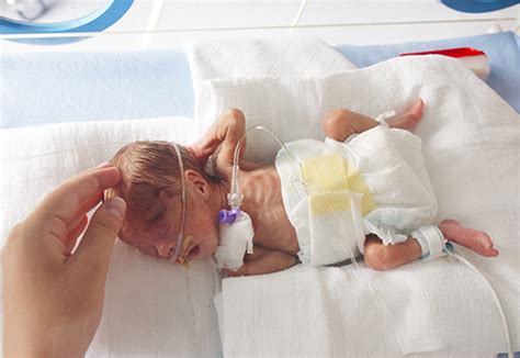 New Nicu Unit Cares For Smallest Of Preemies Mirage News