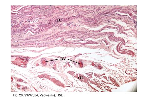 Block Fig W Vagina Ls H E