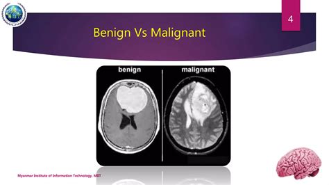 Application Of Image Segmentation In Brain Tumor Detection Pptx Brain And Nervous System