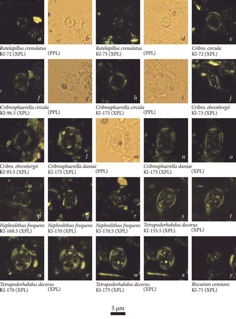 Calcareous Nannofossils From Section Kladorub Stephanolithiaceae Download Scientific Diagram