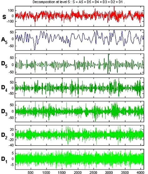 Figure 5 From Classification Of Patient By Analyzing Eeg Signal Using