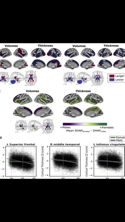 Biological Brain Age Prediction Using Machine Learning On Structural Neuroimaging Dat Rtcl