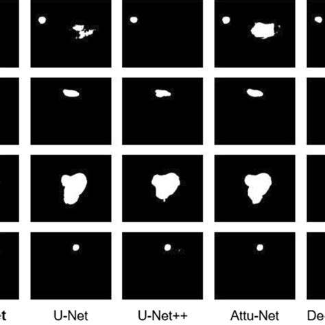 Quantitative Feature Classification Algorithm Process For Breast