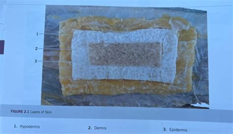 Lab 5 Integumentary Flashcards Quizlet