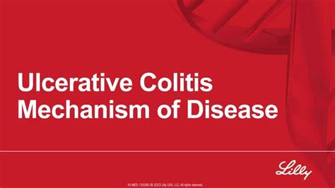 Ulcerative Colitis Disease Education Resources Lilly Medical Education