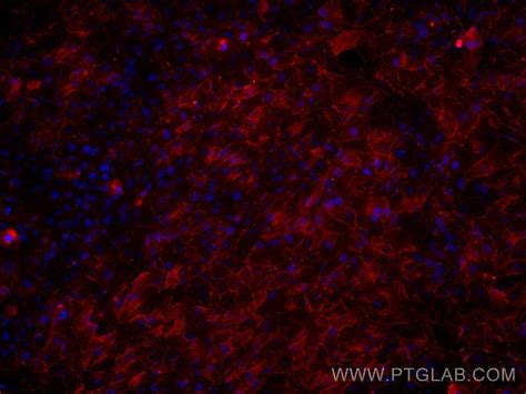 Vinculin Antibody 66305 2 Ig Proteintech
