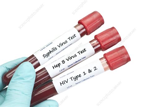 STD Blood Tests Stock Image F035 8876 Science Photo Library