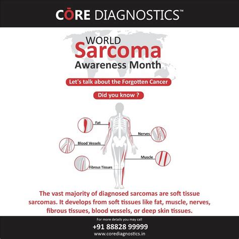 Core Diagnostics On Linkedin Sarcoma Sarcomaawareness Sarcomaawarenessmonth Sarcomawarriors