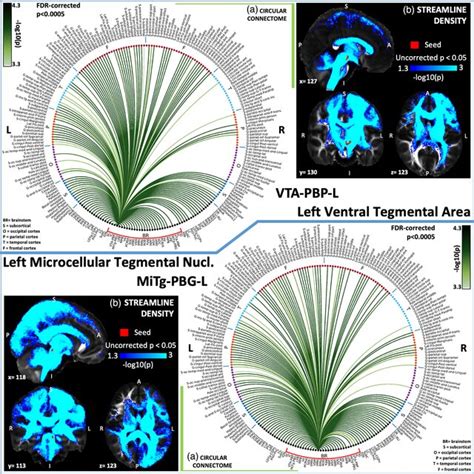 A Region‐based 2d Structural Connectome And B Voxel‐based Download Scientific Diagram