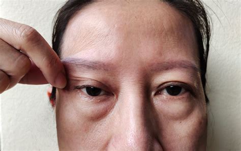 ¿qué Es Un Tic Nervioso Dra Giovana