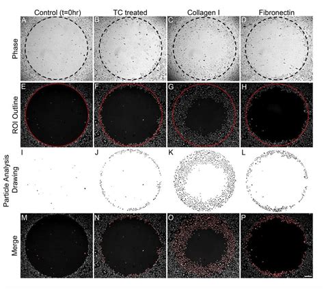 Imagej Software Wound Healing Assay Vastgateway