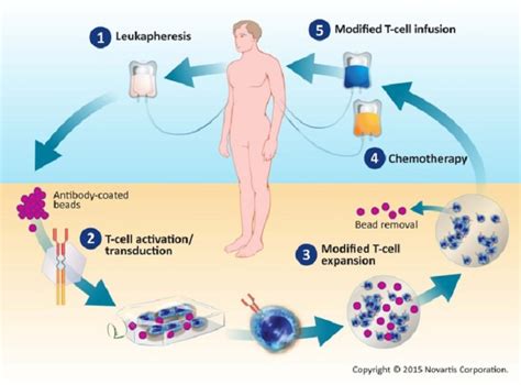 An End To Leukemia A Lifesaving Revolutionary Treatment