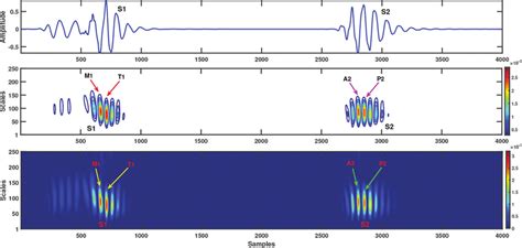 2 A Time Domain PCG Signal Normal B Contour Plot Of A After