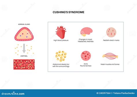 Cushing Disease Cortisol Level At Jenenge Blog